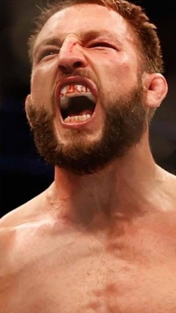 FIGHT FACE NZ - NZ's Leader in Custom Mouthguards